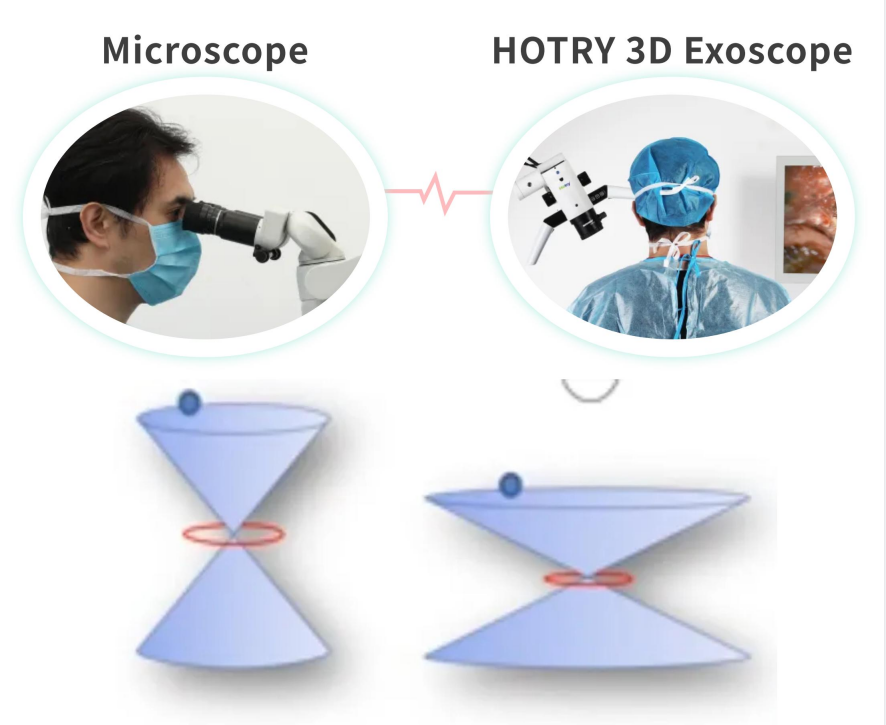 HOTRY 3D·4K Naked Eye Exoscope is Newly Release